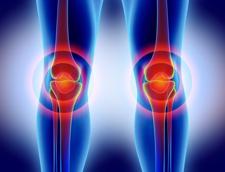 Zmírněte příznaky revmatoidní artritidy | JakZdravě.cz