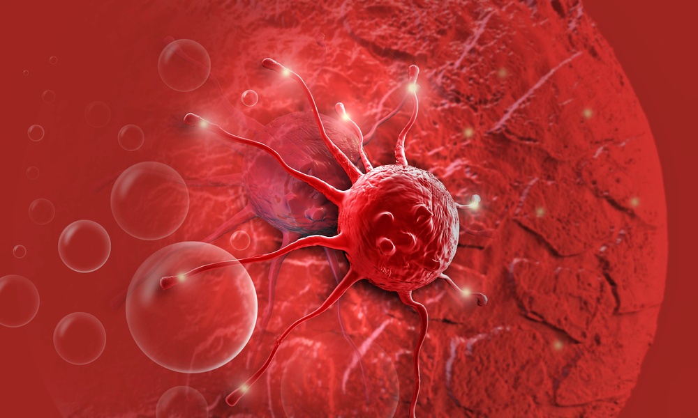 Příznaky rakoviny se nemusí objevit ihned | JakZdravě.cz