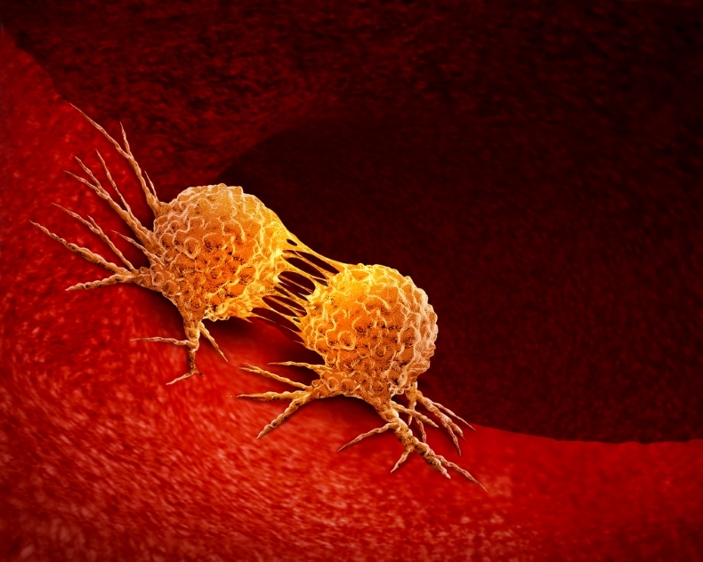 Krevní test dokáže odhalit šíření rakoviny | JakZdravě.cz