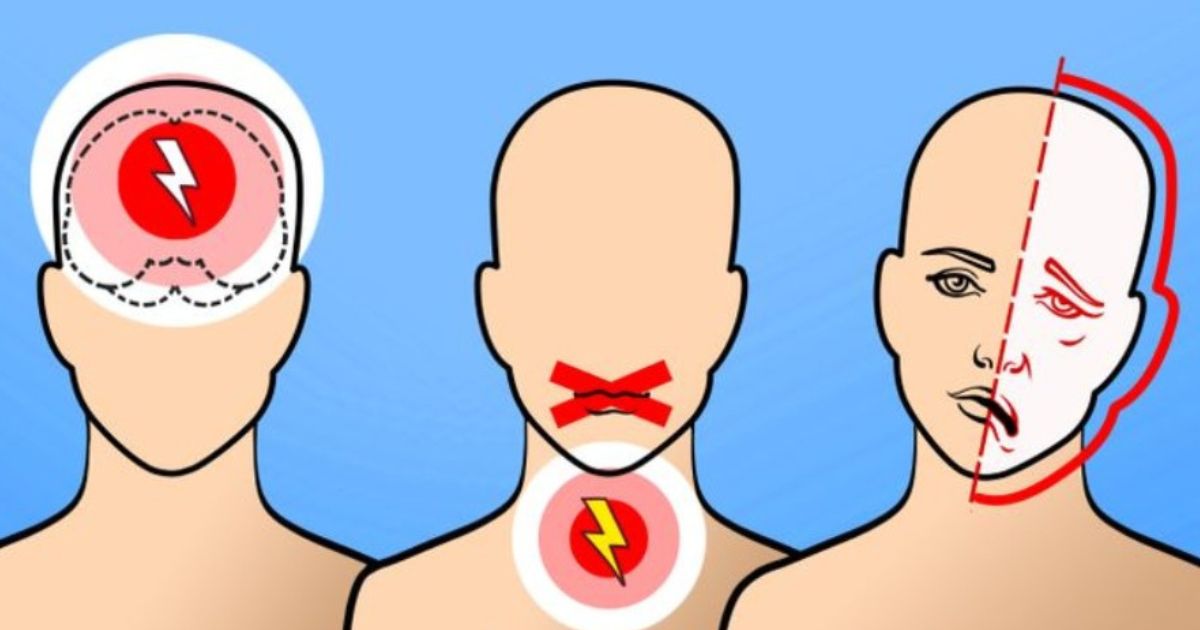 8 nejčastějších příčin mozkové mrtvice | JakZdravě.cz