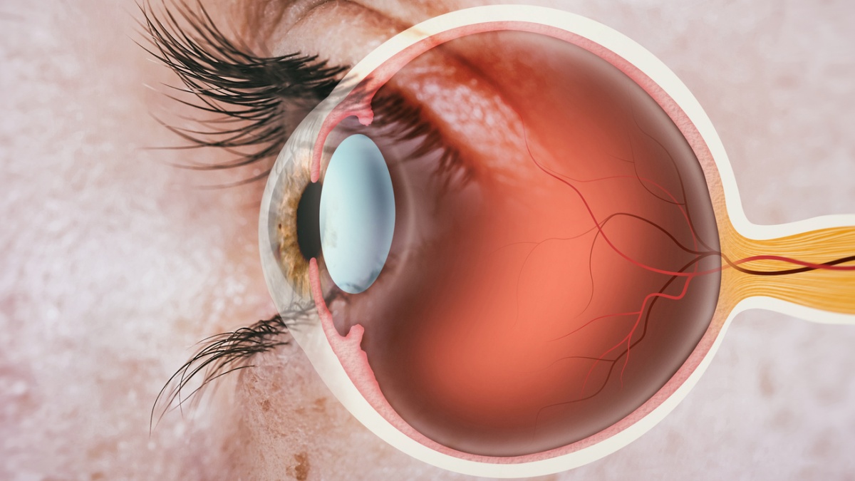 Ztenčení sítnice jako příznak demence |JakZdravě.cz