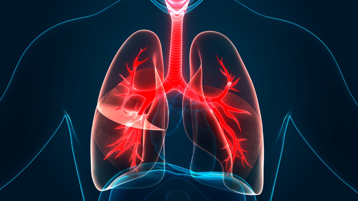 Toto jsou příznaky plicní infekce a hlavně důvody, proč jít k lékaři