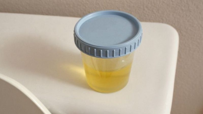 Hyperaktivní močový měchýř: Jak na něj a co nikdy nedělat