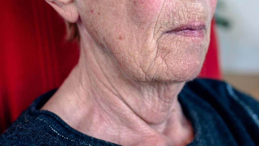 Jakými příznaky se projevuje rakovina hrdla | JakZdravě.cz