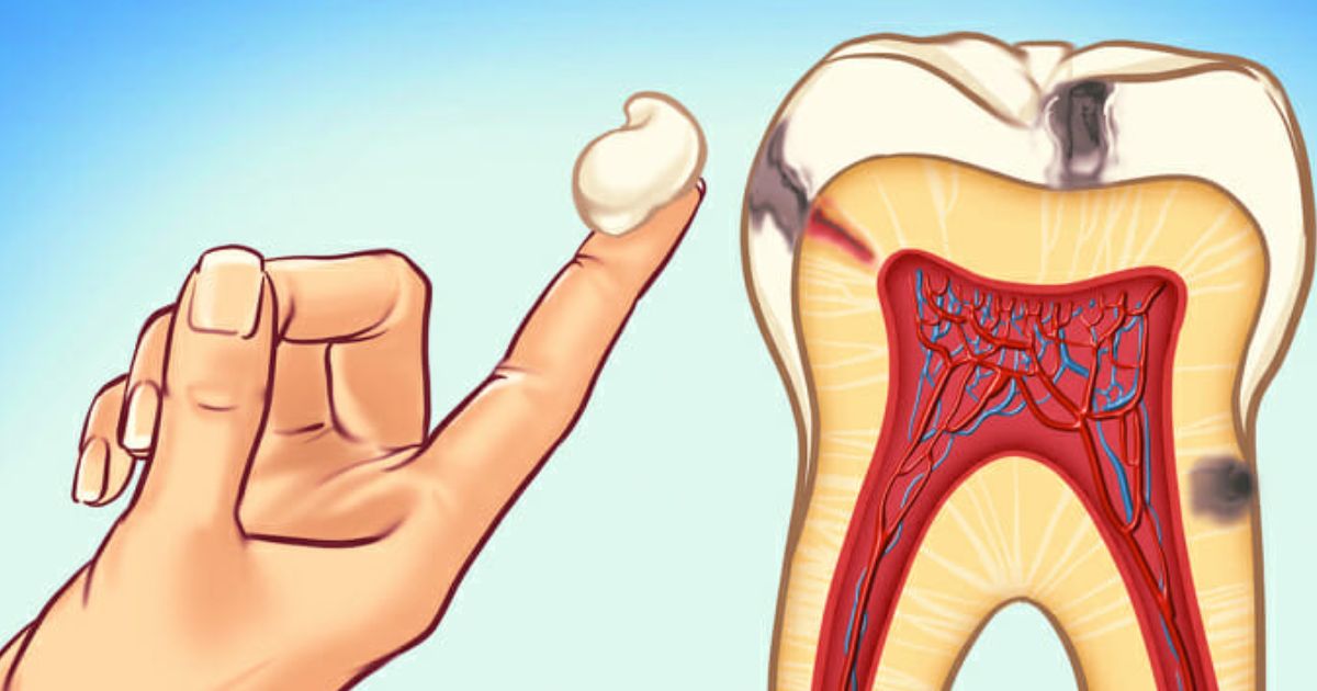 Jednoduchý recept proti bolesti zubů | JakZdravě.cz