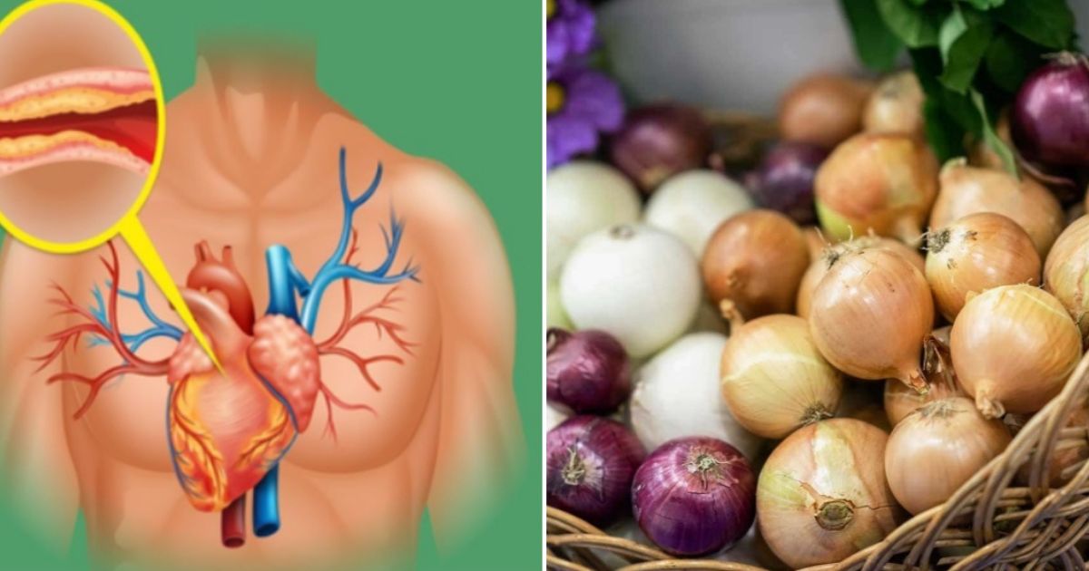 7 úžasných zdravotních výhod cibule | JakZdravě.cz