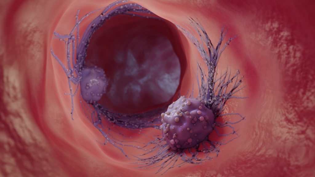 Pozor na tyto potraviny, podporují vznik rakovinových buněk