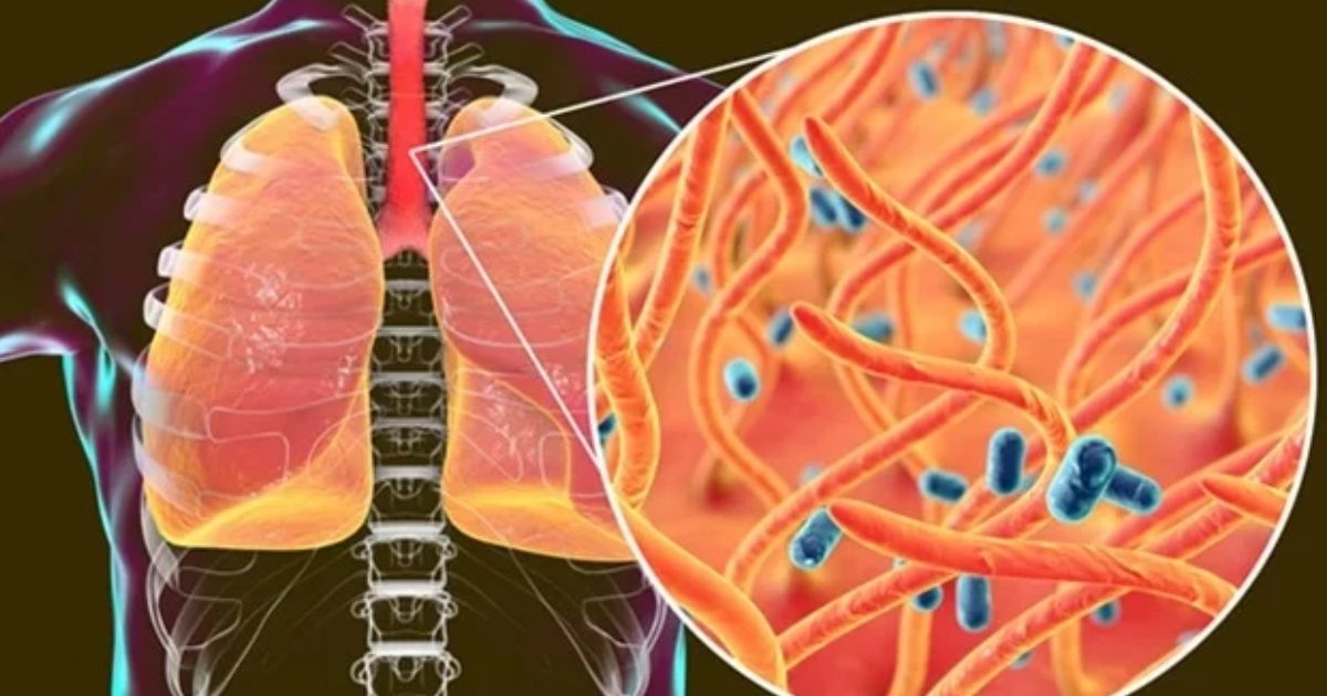 Černý kašel je na vzestupu, nepodceňujte příznaky