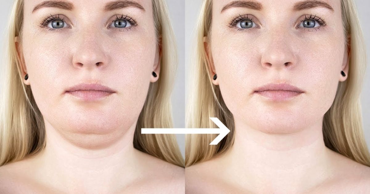 10 jednoduchých tipů, jak se bez plastiky zbavit druhé brady