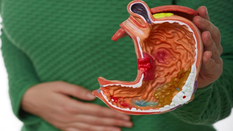 Přirozený způsob, jak odstranit bakterie z žaludku už za 2 dny