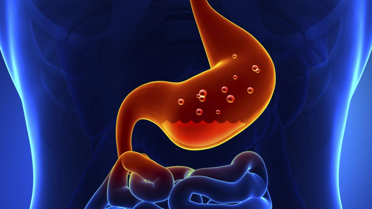 Vyzrajte na pálení žáhy a zažijte úlevu už za 5 minut