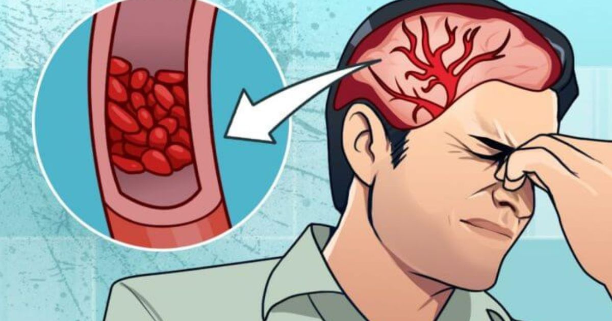 Chronická bolest hlavy: Co dělat, když vás bolí hlava každý den?