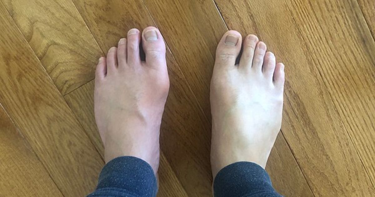 Dna a jak proti ní účinně bojovat přírodními prostředky