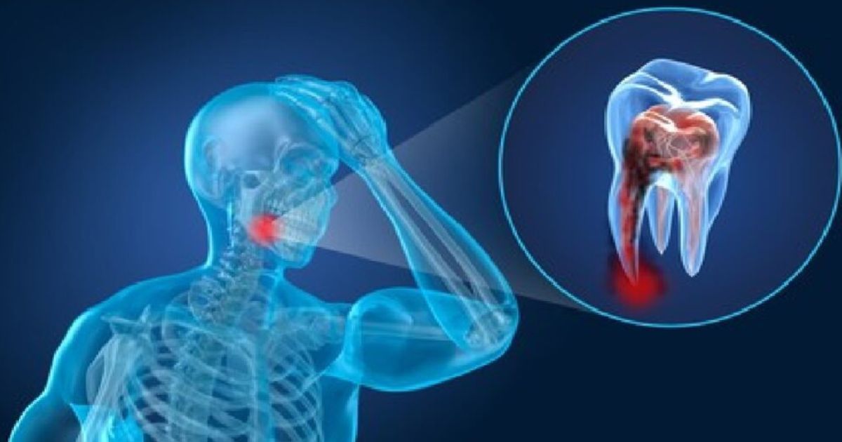 Ulevte si od nepříjemné bolesti zubů v pohodlí domova