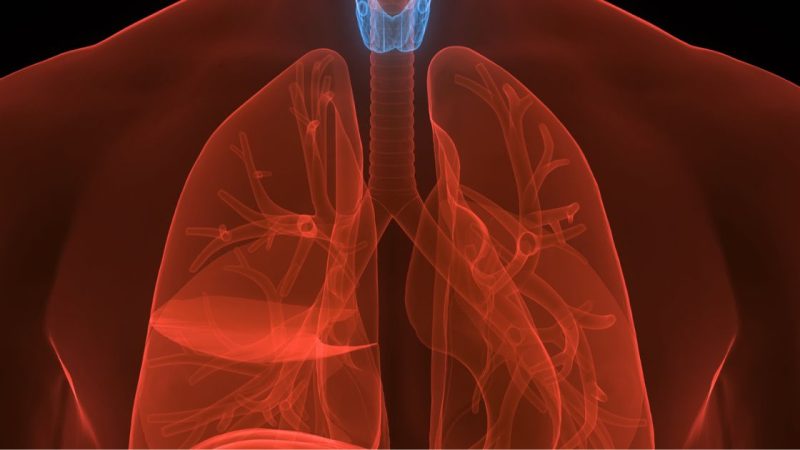 Bronchitida aneb Zánět průdušek: Příznaky, které musíte znát