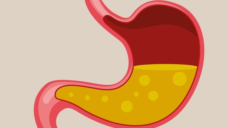 Které potraviny vynechat při refluxu žaludku a pálení žáhy